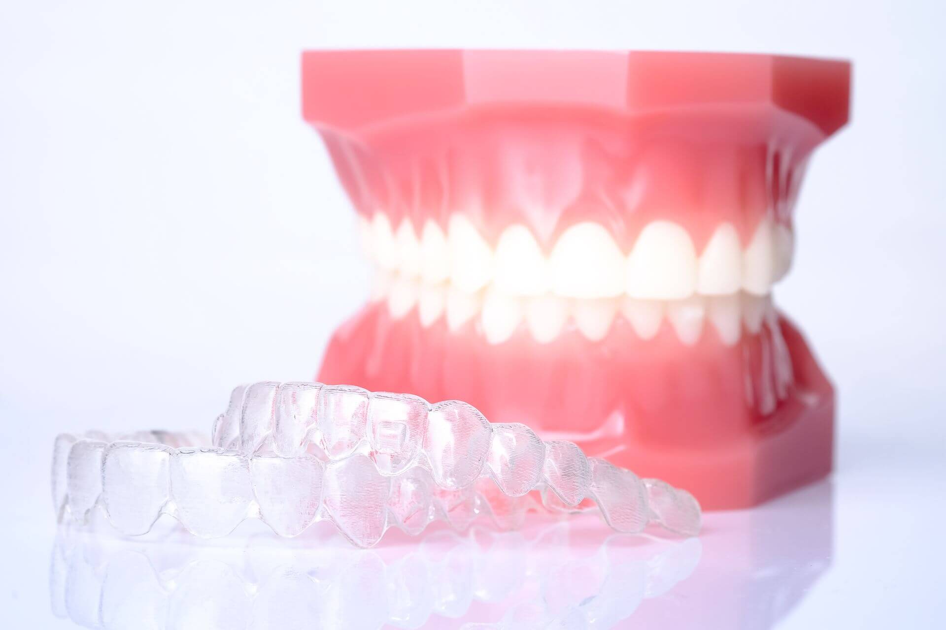 Ortodonzia invisibile: apparecchio dentale fisso interno - STUDIO RENDA Ortodonzia invisibile: apparecchio dentale fisso interno - STUDIO RENDA