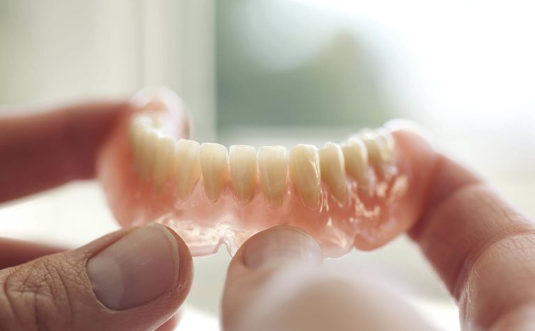 Protesi mobili dentali: tipologie, durata, pulizia e manutenzione ...